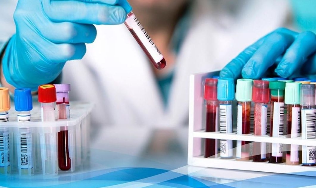 La labor del bioanalista es básica en la detección de enfermedades ...